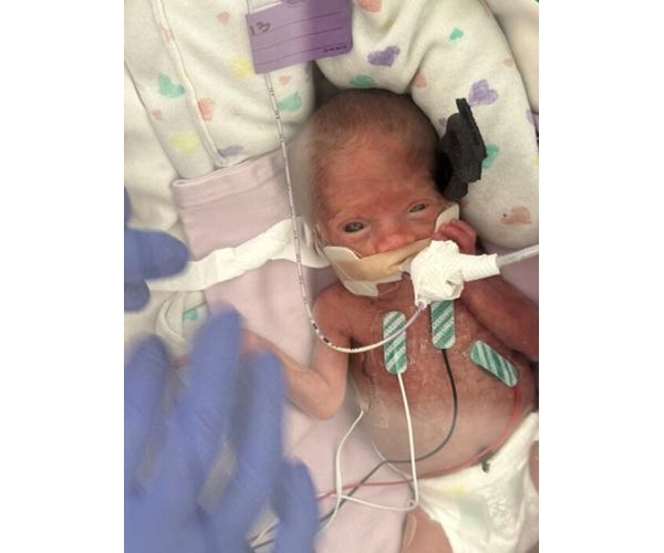 Arya Lynn Van Volkenburgh Obituary (2025) - North Vernon, IN - Dove ...