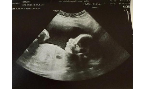 Emma Grace McDaniel Obituary (2026) - Lexington, KY - Engle-Bowling ...